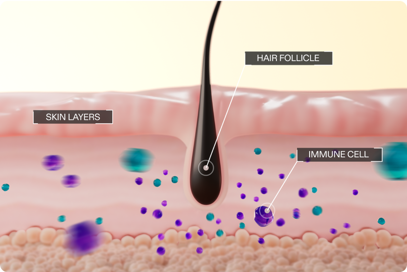 Unlocking Hair Regrowth: How Litfulo Revolutionizes Alopecia Treatment